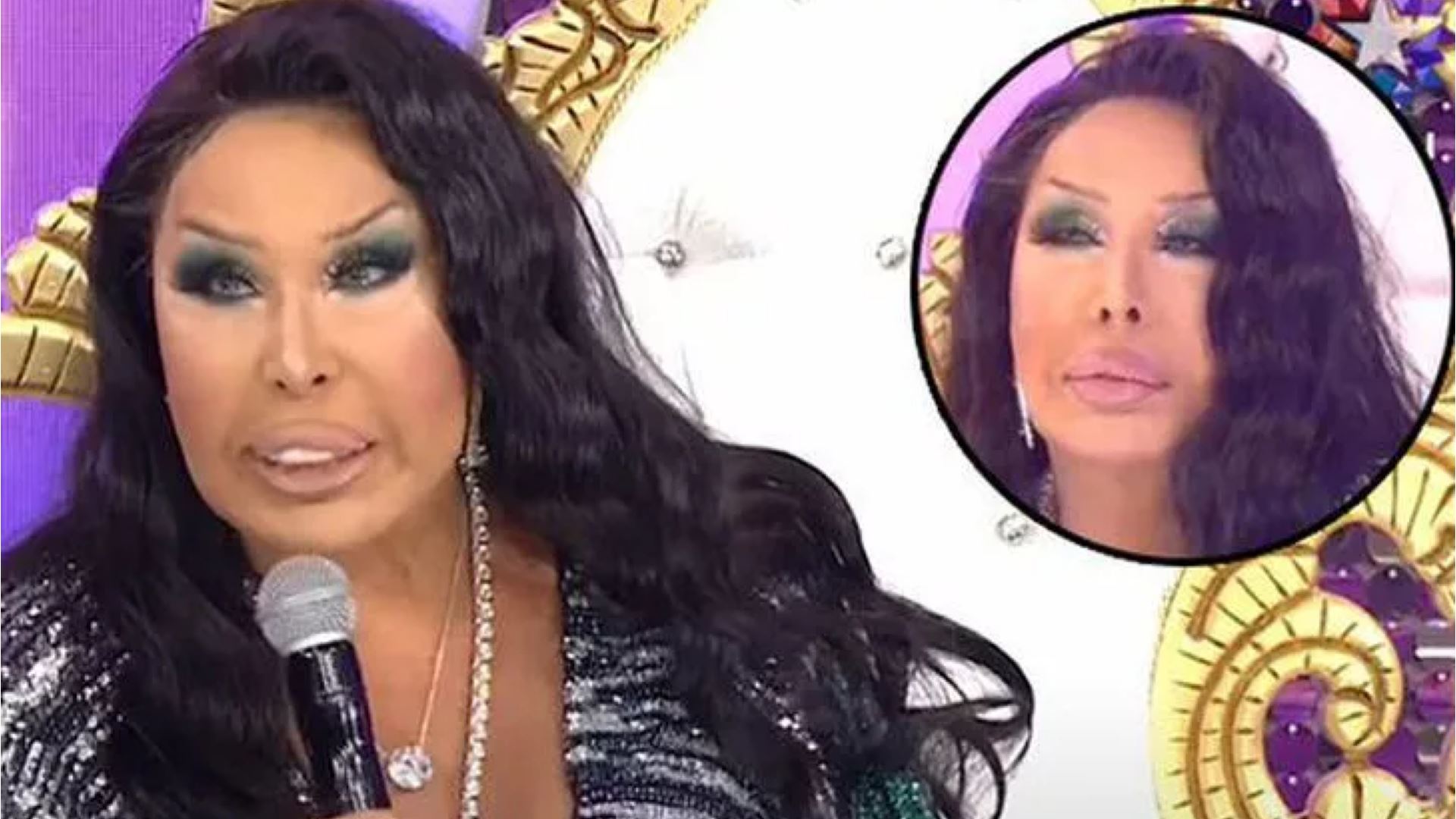 Bülent Ersoy yüzündeki değişimin sebebini açıkladı